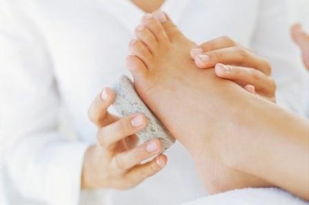 How to Get Rid of Corns on Toes, Pinky Toe, Fast, Naturally, on Bottom ...
