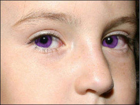 Purple Eyes – Causes, Purple Eye Color Disease, Makeup Tips, Were ...