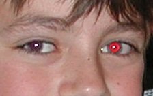 Red Eyes in Photos – Causes, Prevention and How to Fix Red Eye Pictures