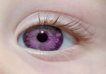 Violet Eyes – Natural, Elizabeth Taylor, Makeup Tips, Disease, Mutation ...