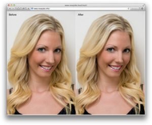 Nose Job Simulator, Virtual Nose Job, Free, Online Virtual Nose Surgery