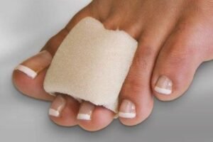Corns on Toes, Between Toes, Causes, How to Remove, Treat, Hide ...